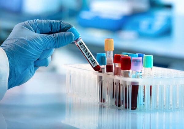 MED-1 Occupational Health Services | Employee Drug Testing